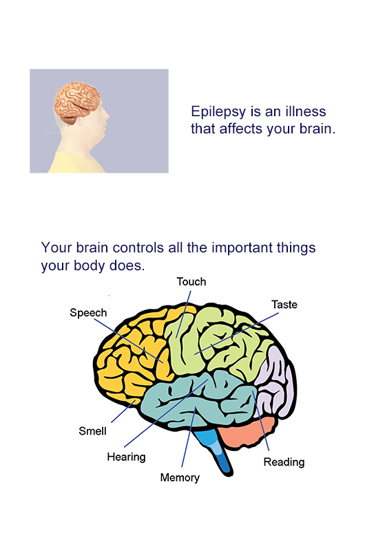 Understanding Epilepsy - Talking Media | Accessibility for All | BTM ...